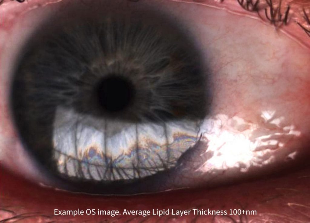 LIPIVIEW – Oftomed